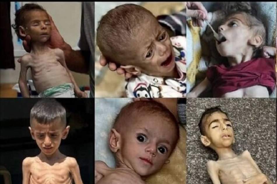 Gaza Medical Relief Director Reports on Deteriorating Health ...
